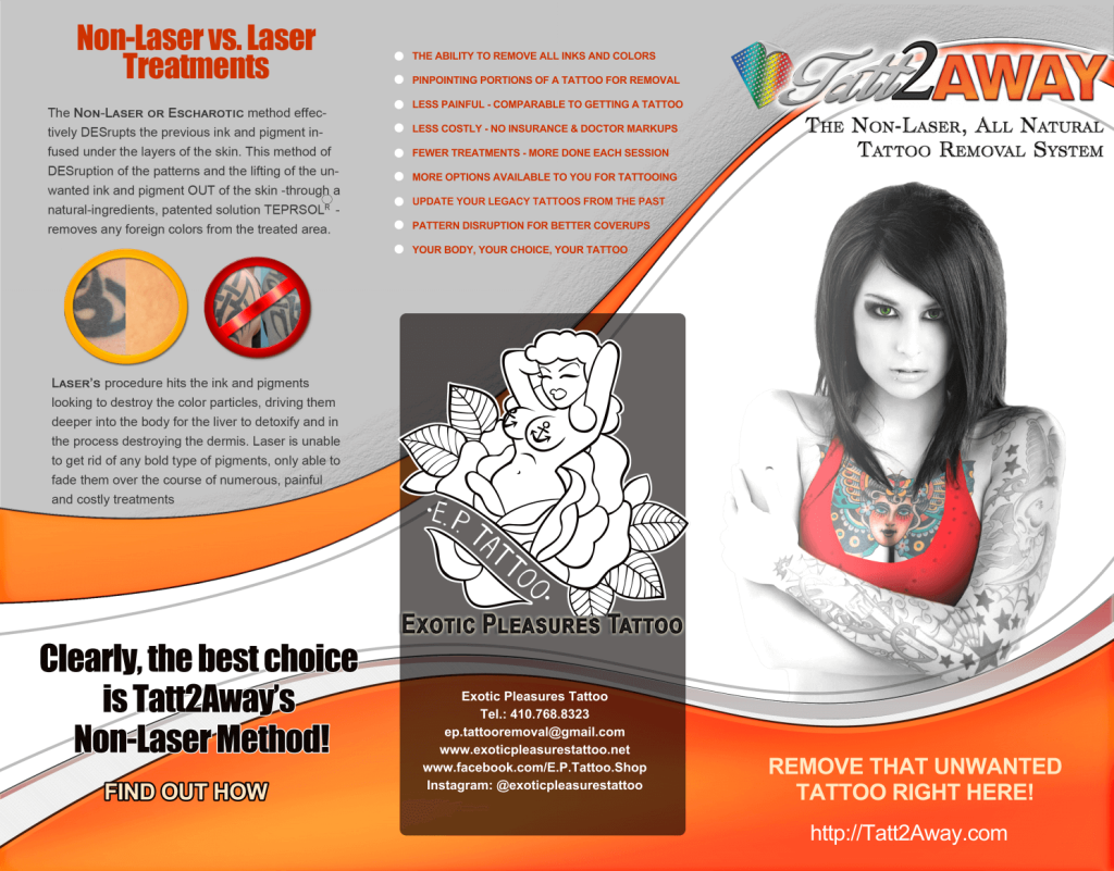 Exotic Pleasures Tattoo - Tattoo Removal - Tatt2Away